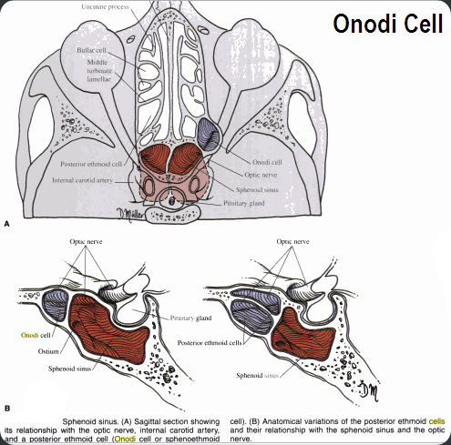 Medicine Decoded: Onodi cell & Haller cell
